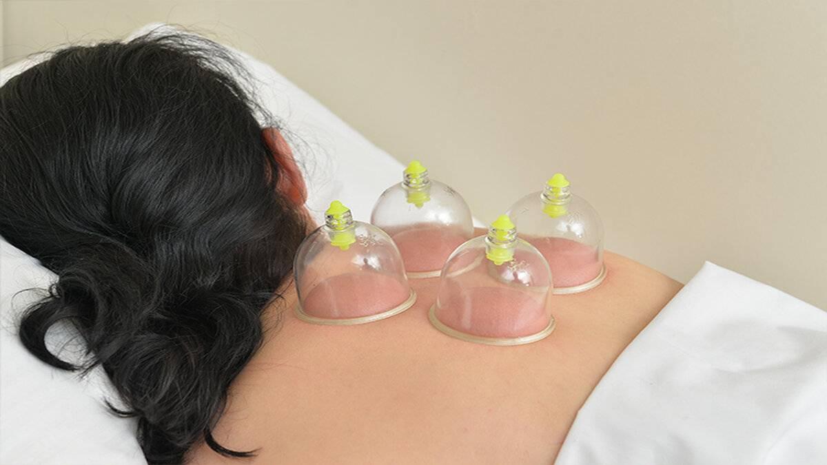 Binlerce yıllık gelenek: Hacamat sahiden yararlı mı? - Derdi Dedikodu